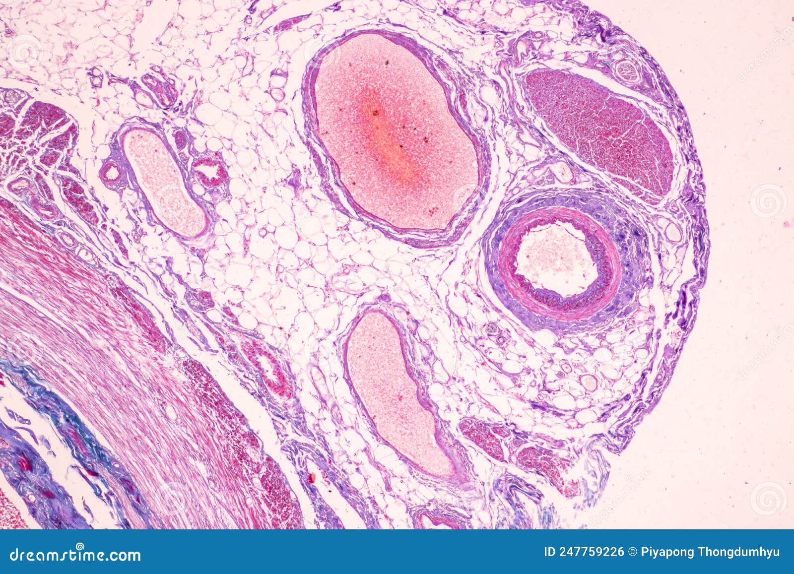 Human Vermiform Appendix Royalty-Free Stock Photo | CartoonDealer.com ...