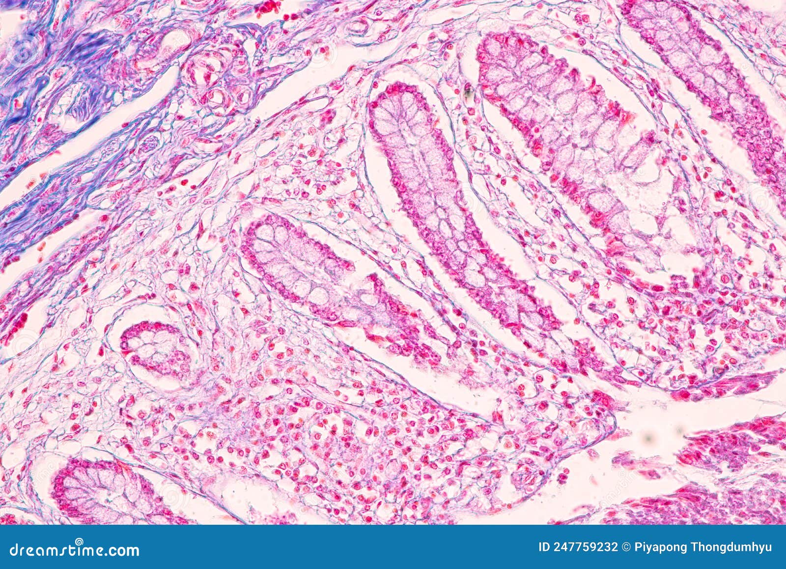 Small Intestine Duodenum and Vermiform Appendix Human Under the ...