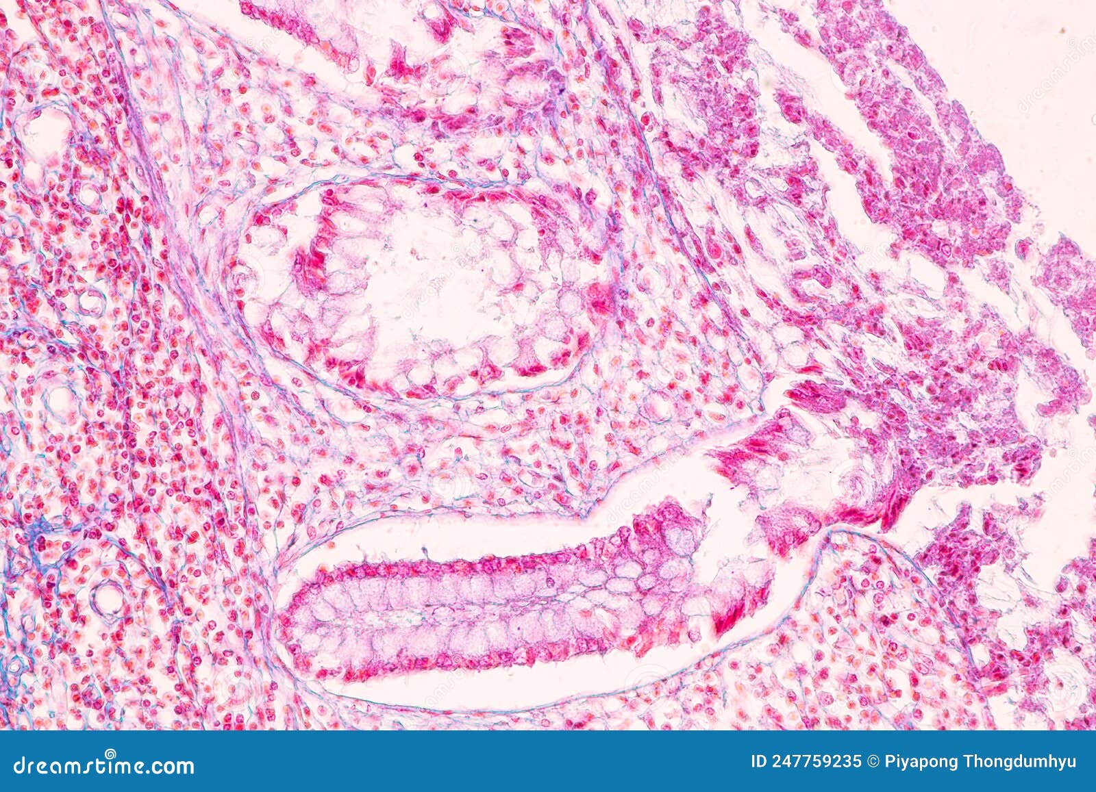 Small Intestine Duodenum and Vermiform Appendix Human Under the ...