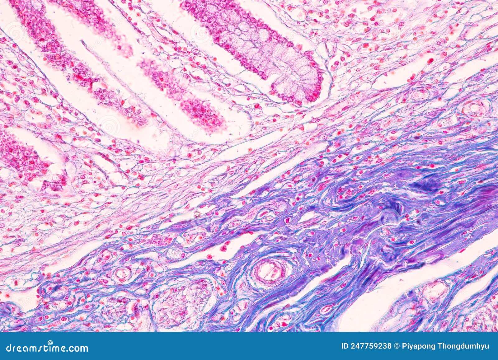 Small Intestine Duodenum and Vermiform Appendix Human Under the ...