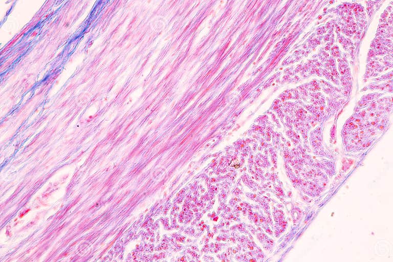 Small Intestine Duodenum and Vermiform Appendix Human Under the ...