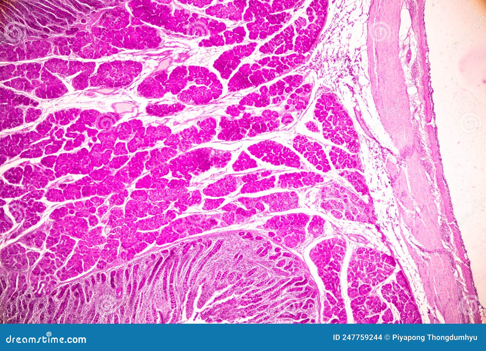 Small Intestine Duodenum And Vermiform Appendix Human Under The ...