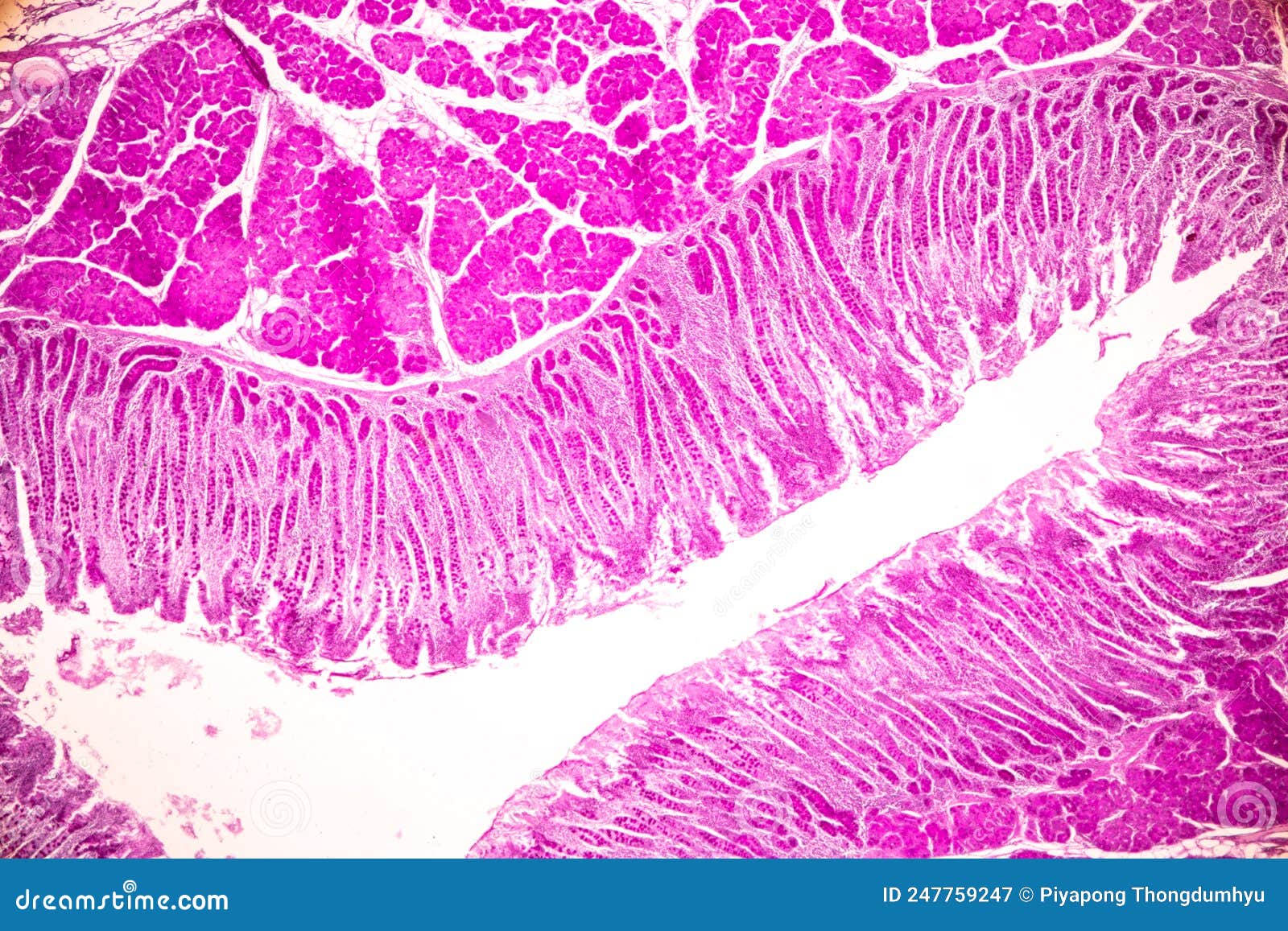 Human Vermiform Appendix Royalty-Free Stock Photo | CartoonDealer.com ... Human Vermiform Appendix Royalty-Free Stock Photo | CartoonDealer.com ...