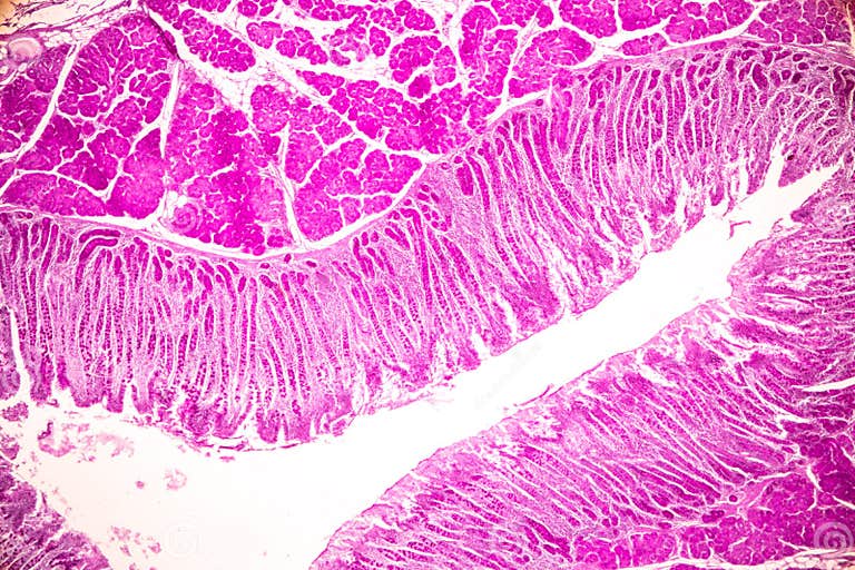 Small Intestine Duodenum and Vermiform Appendix Human Under the ...