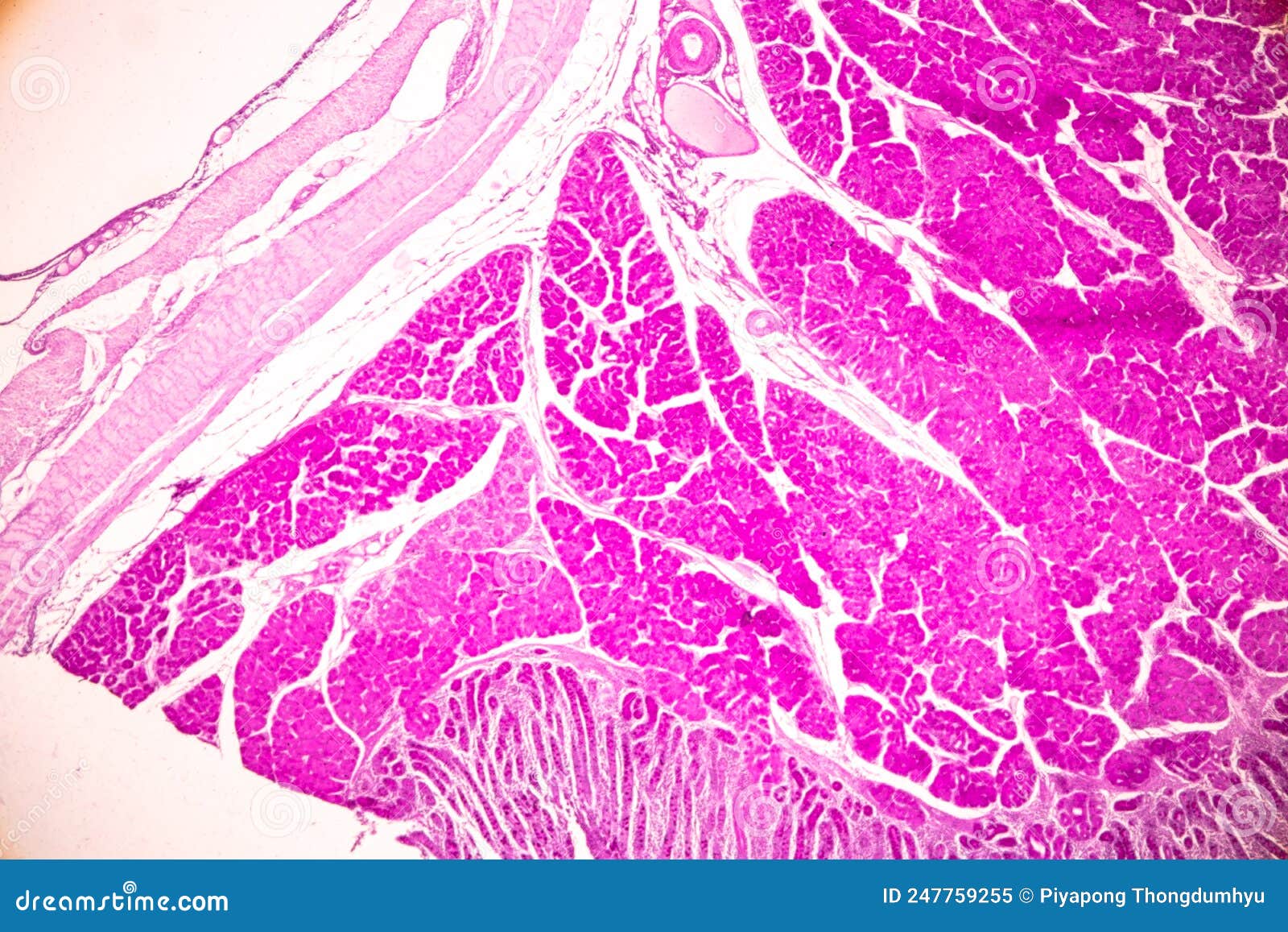 Small Intestine Duodenum and Vermiform Appendix Human Under the ...