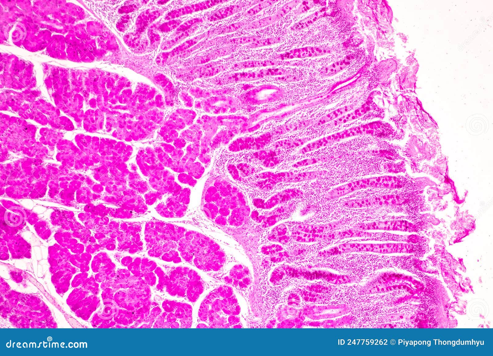 Human Vermiform Appendix Royalty-Free Stock Photo | CartoonDealer.com ...