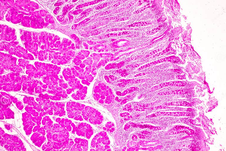 Small Intestine Duodenum and Vermiform Appendix Human Under the ...