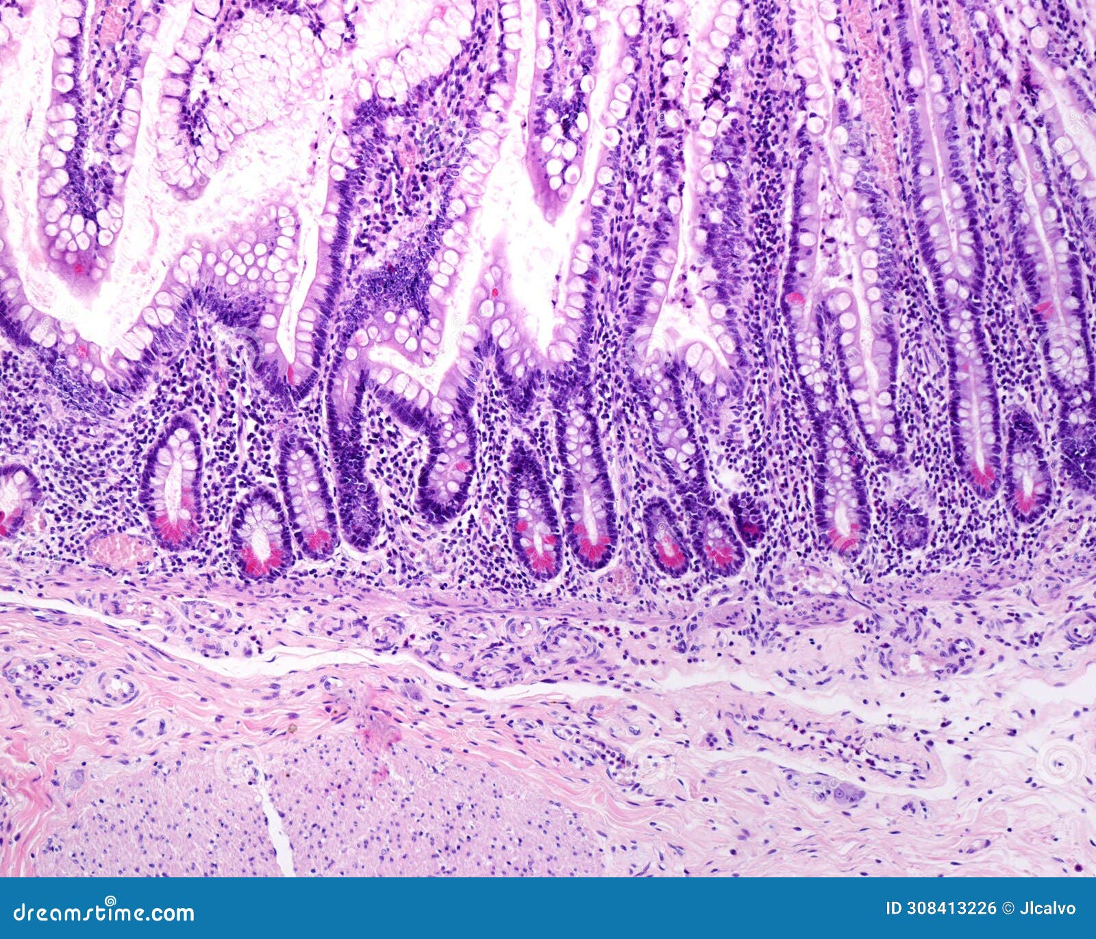 Small Intestine. Paneth Cells Stock Photo - Image of lieberkuhn ...