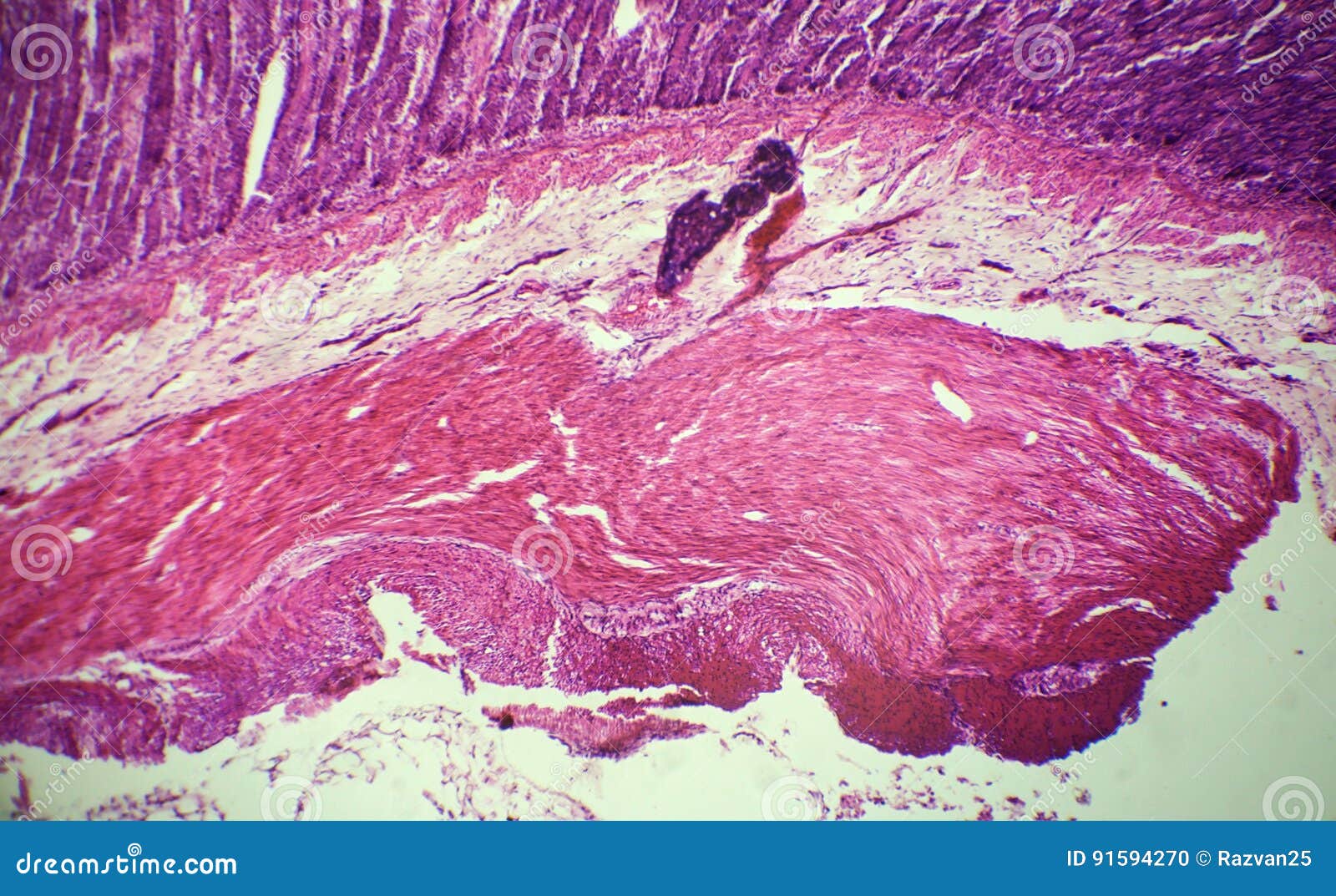 Small Intestine Section Under the Microscope Stock Photo - Image of ...