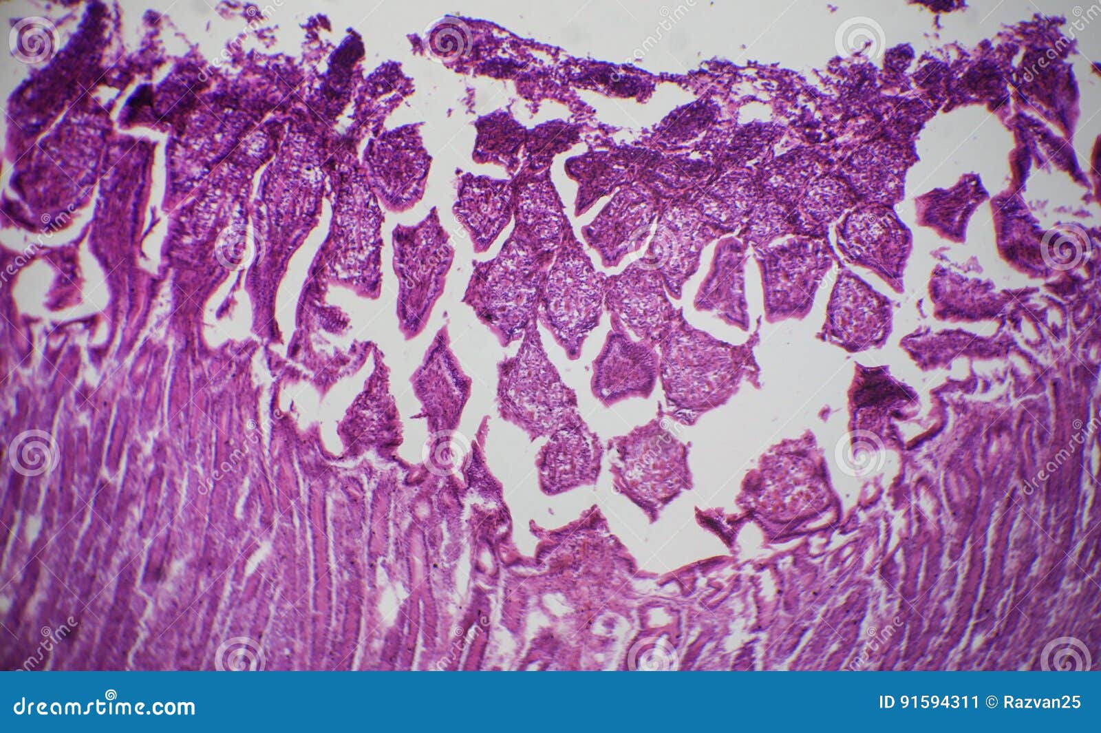 Small Intestine Section Under the Microscope Stock Image - Image of ...