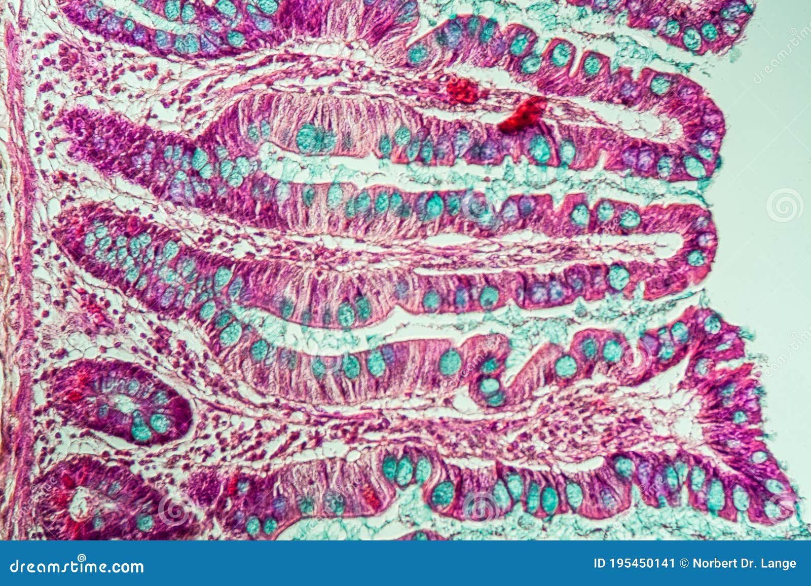 Small Intestine with Villi Under the Microscope Stock Image - Image of ...