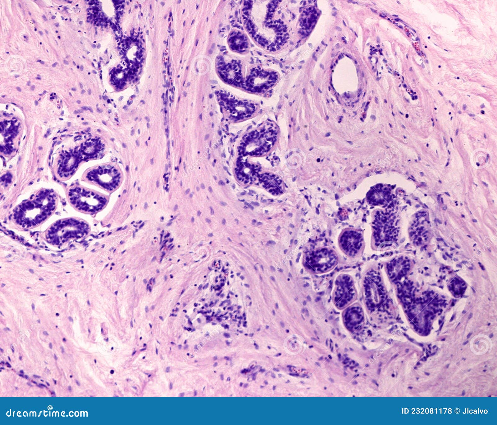 Human breast gland stock photo. Image of tdlu, terminal - 232081178