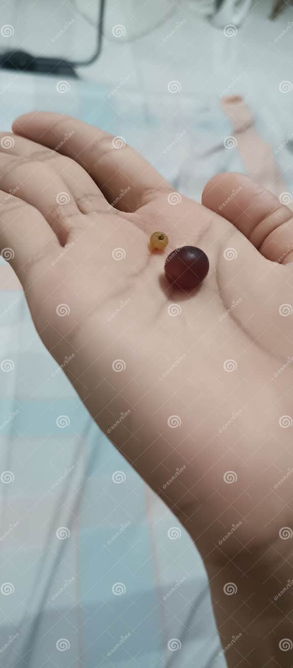 Smallest Grape I Have Ever Seen Stock Image - Image of smallest, grape ...