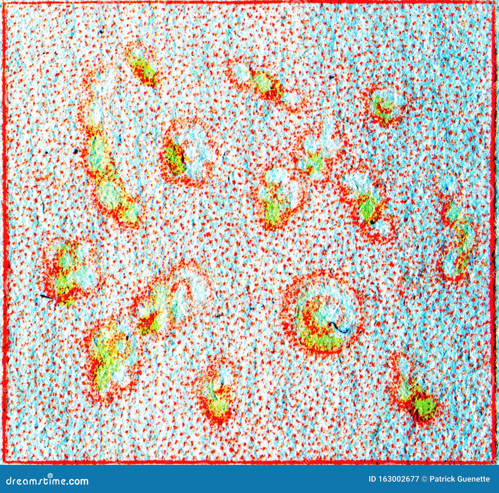 Smallpox, Vintage Engraving Royalty-Free Cartoon | CartoonDealer.com ...