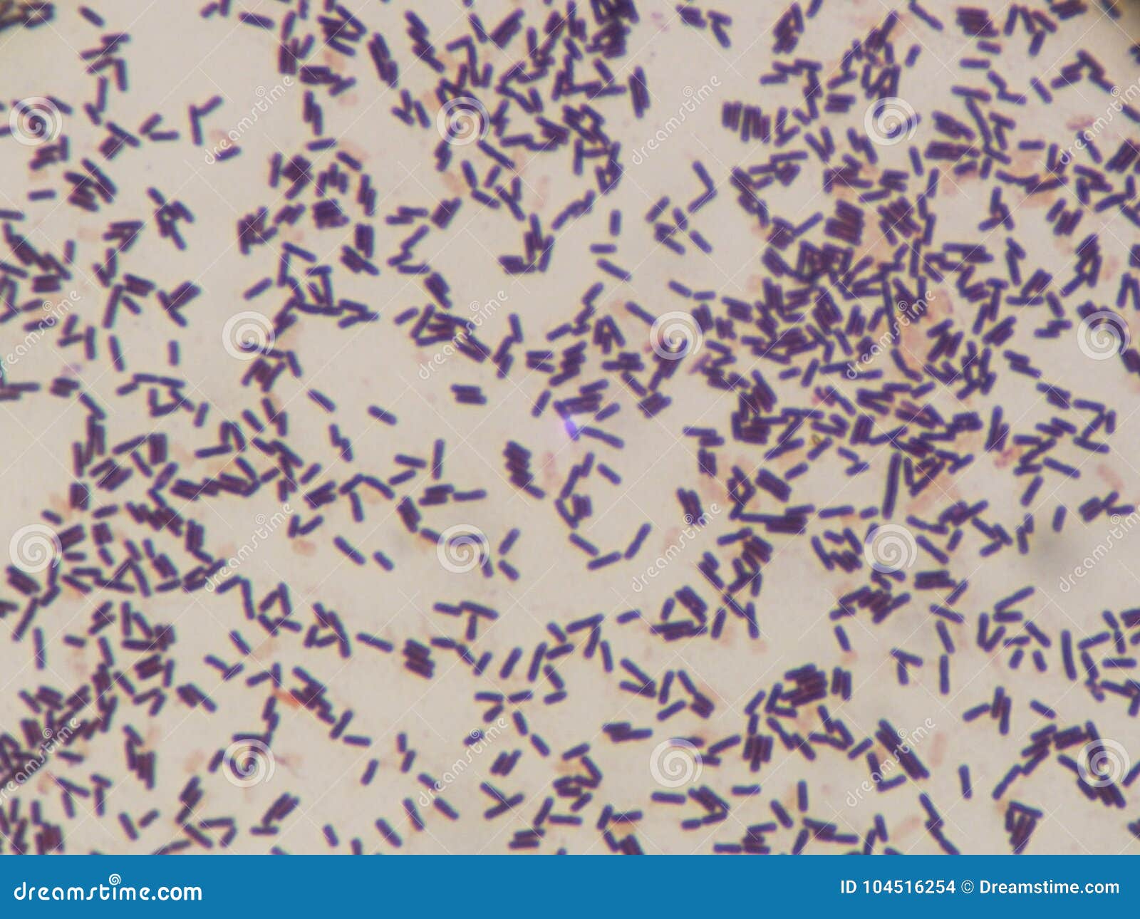 Bacteria gram negative stock photo. Image of optical - 104516254 Bacteria gram negative stock photo. Image of optical - 104516254
