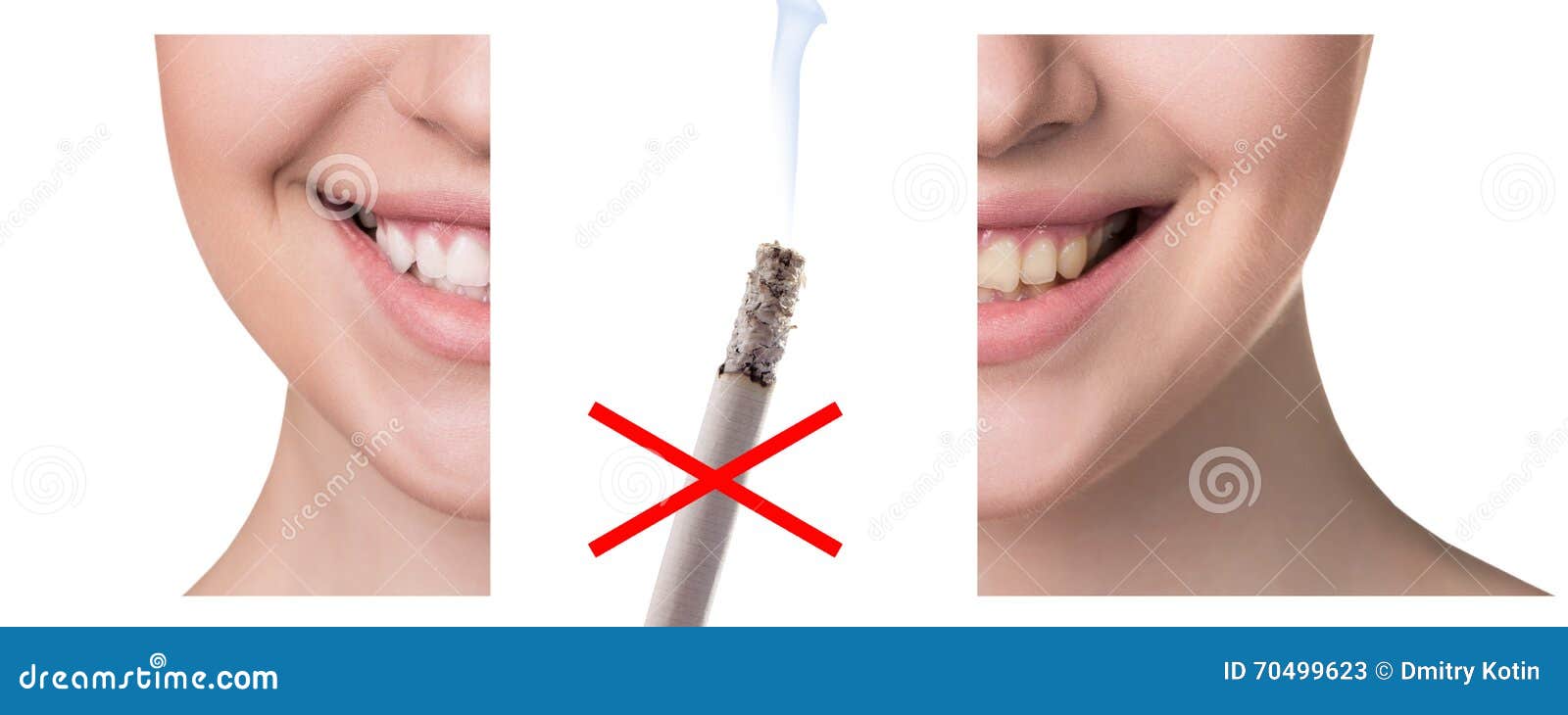Smile before and after Smoking. Stock Image - Image of horizontal ...