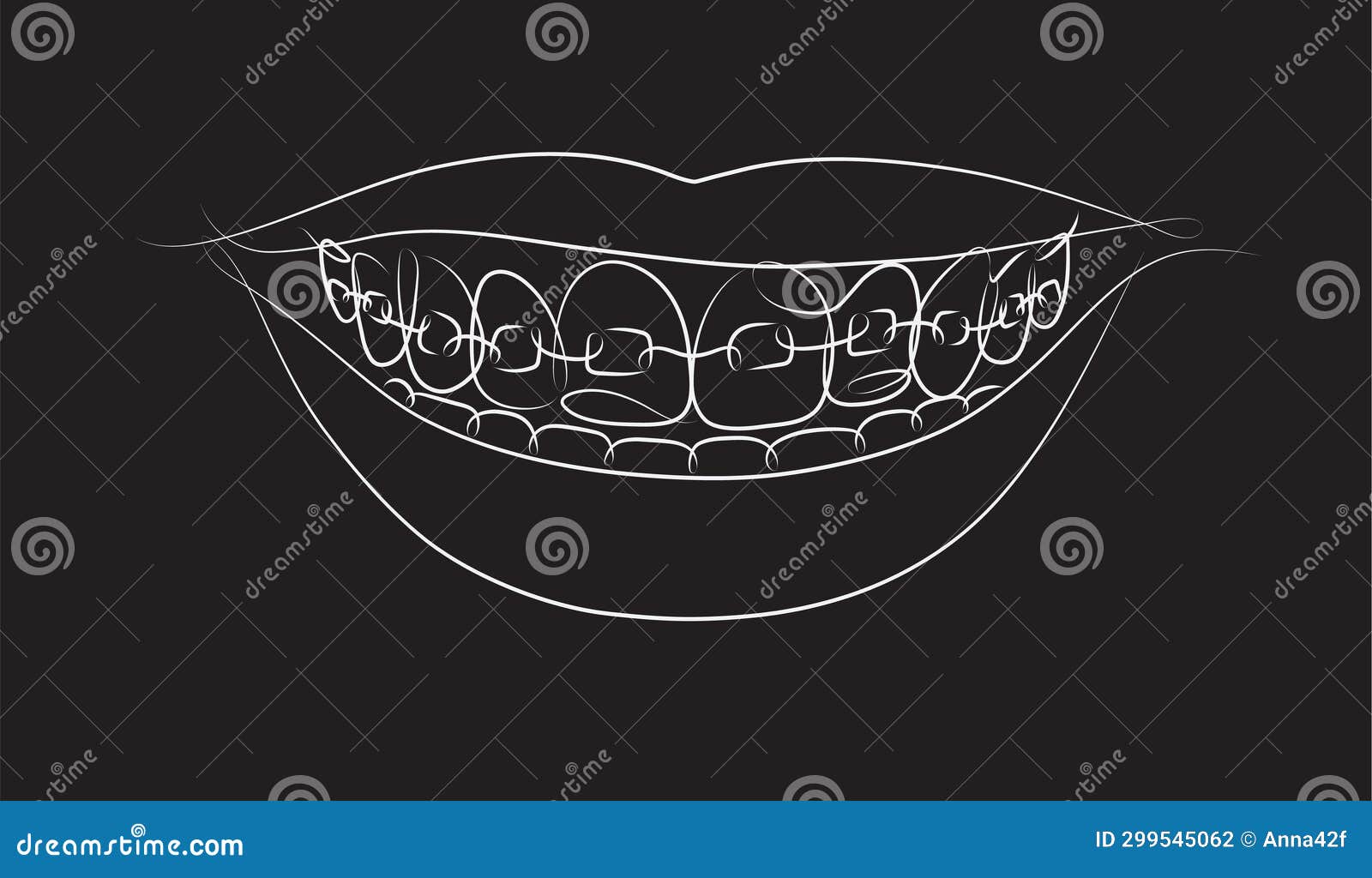 Smile with Teeth Braces Black Color Stock Vector - Illustration of ...