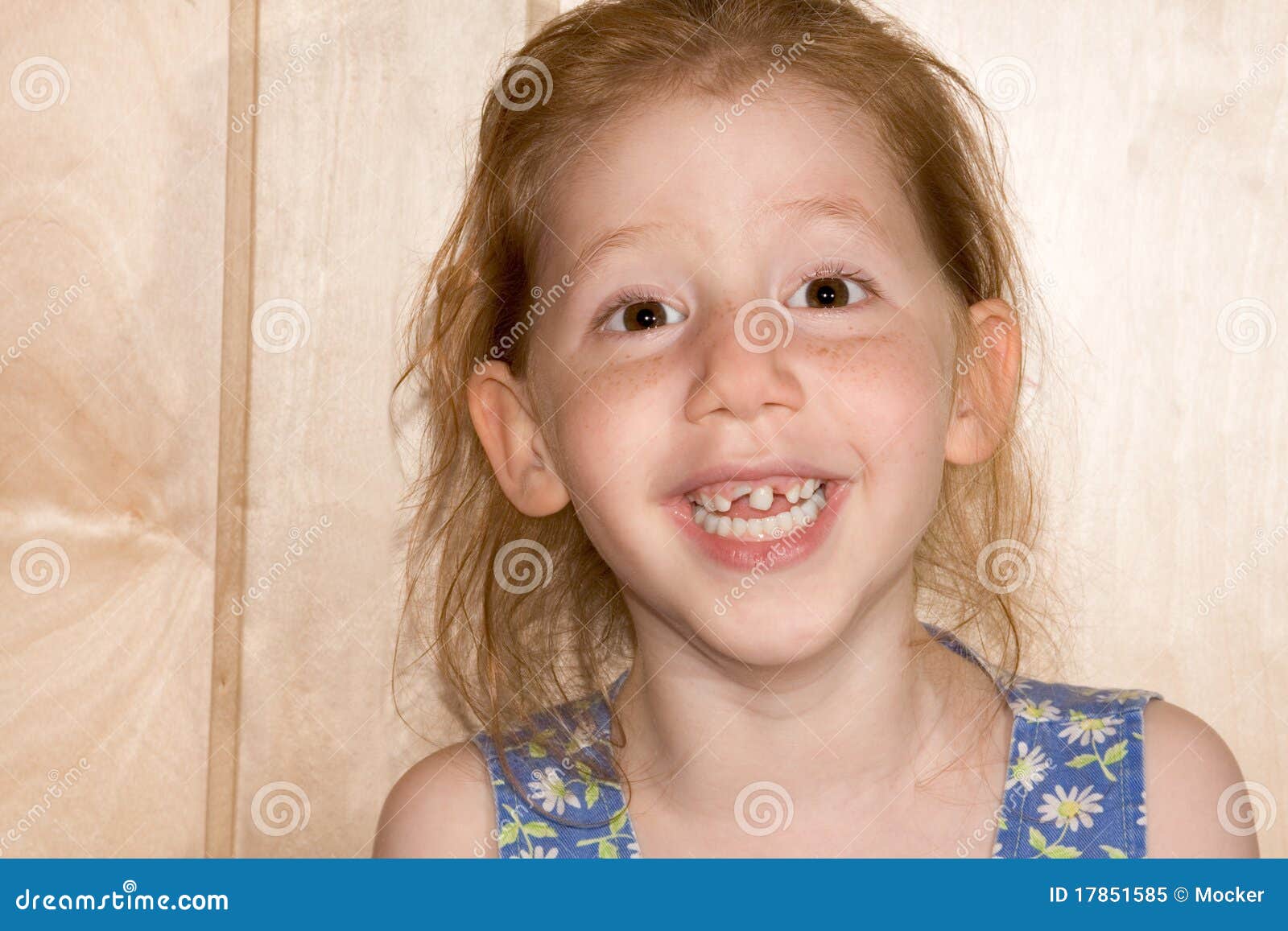 Smiling Girl Showing Her Fallen Off Snaggle Teeth Stock Image - Image ...