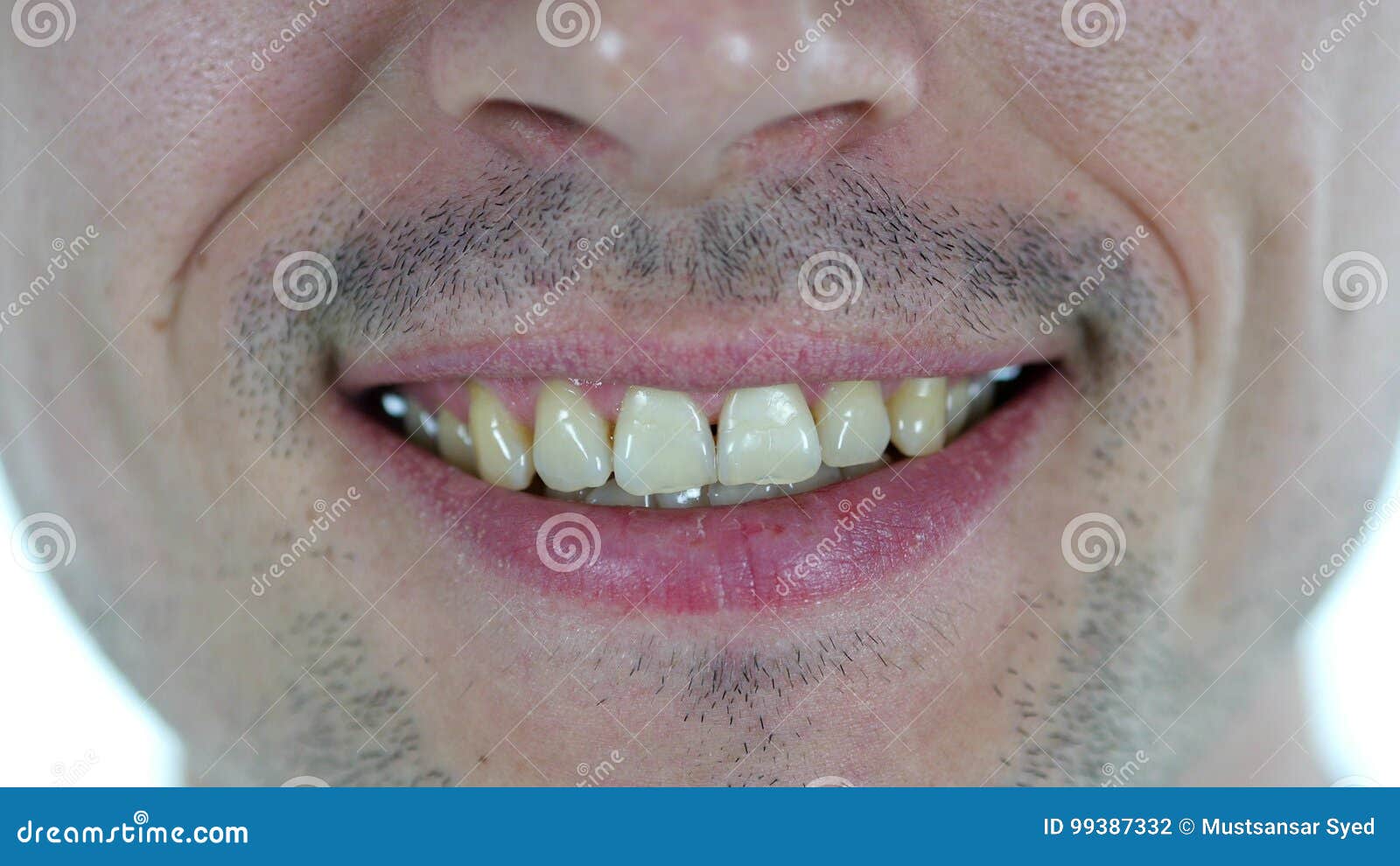 Smiling Lips of Man, on White Background Stock Photo - Image of hairs ...