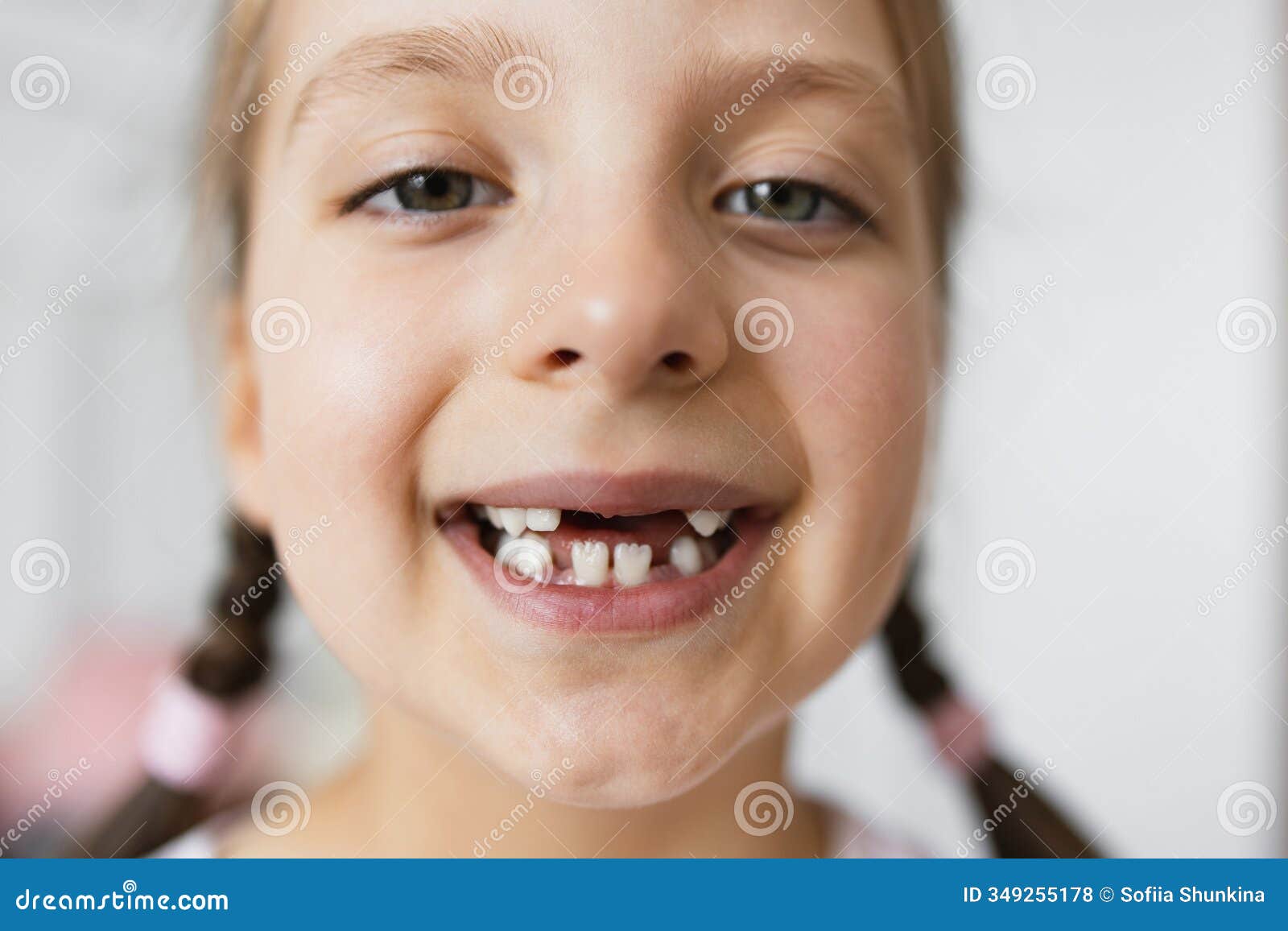 Smiling Little Girl with Missing Baby Teeth at Home Stock Photo - Image ...