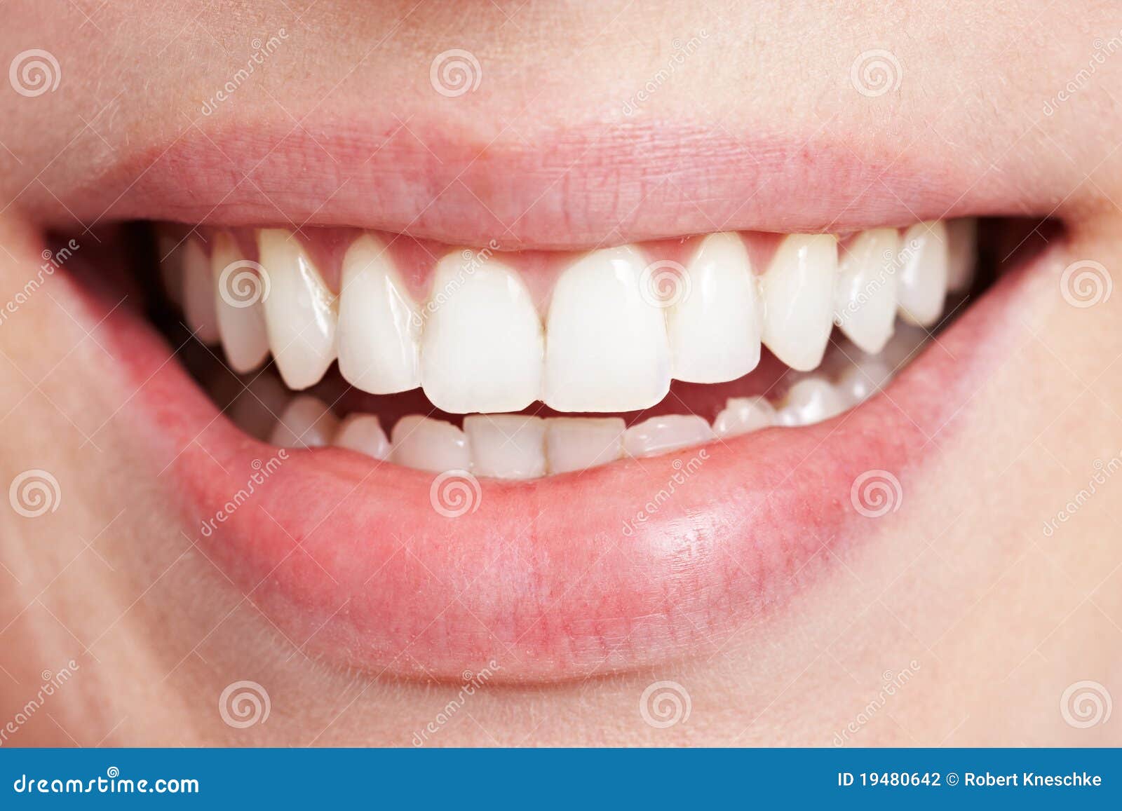 Smiling white teeth stock photo. Image of dentist, perfect - 19480642