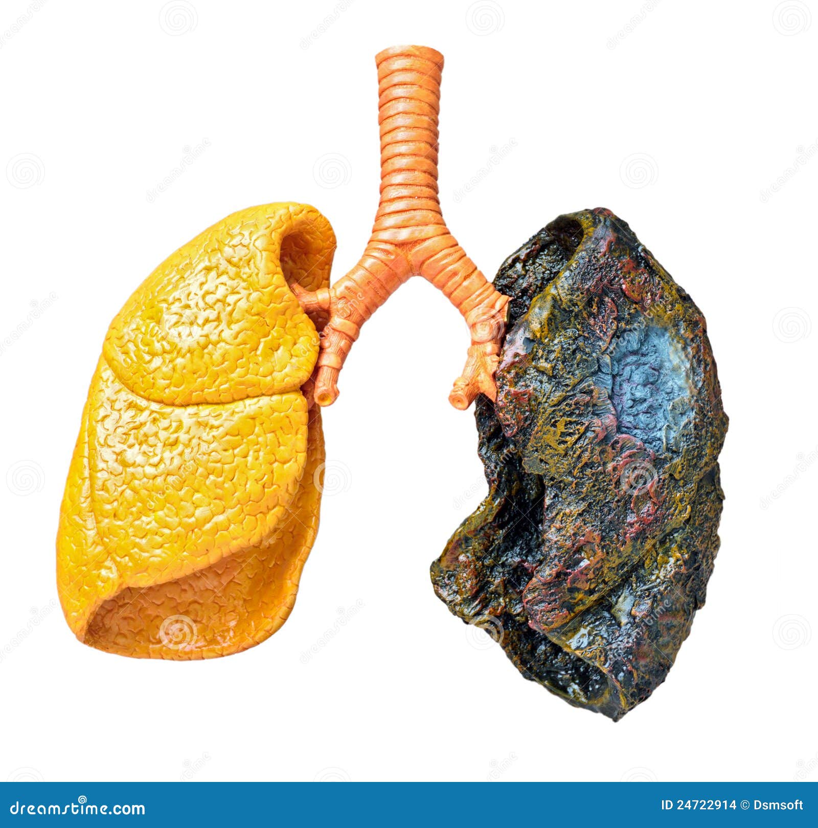 Smoking kills! stock photo. Image of injury, anatomy - 24722914