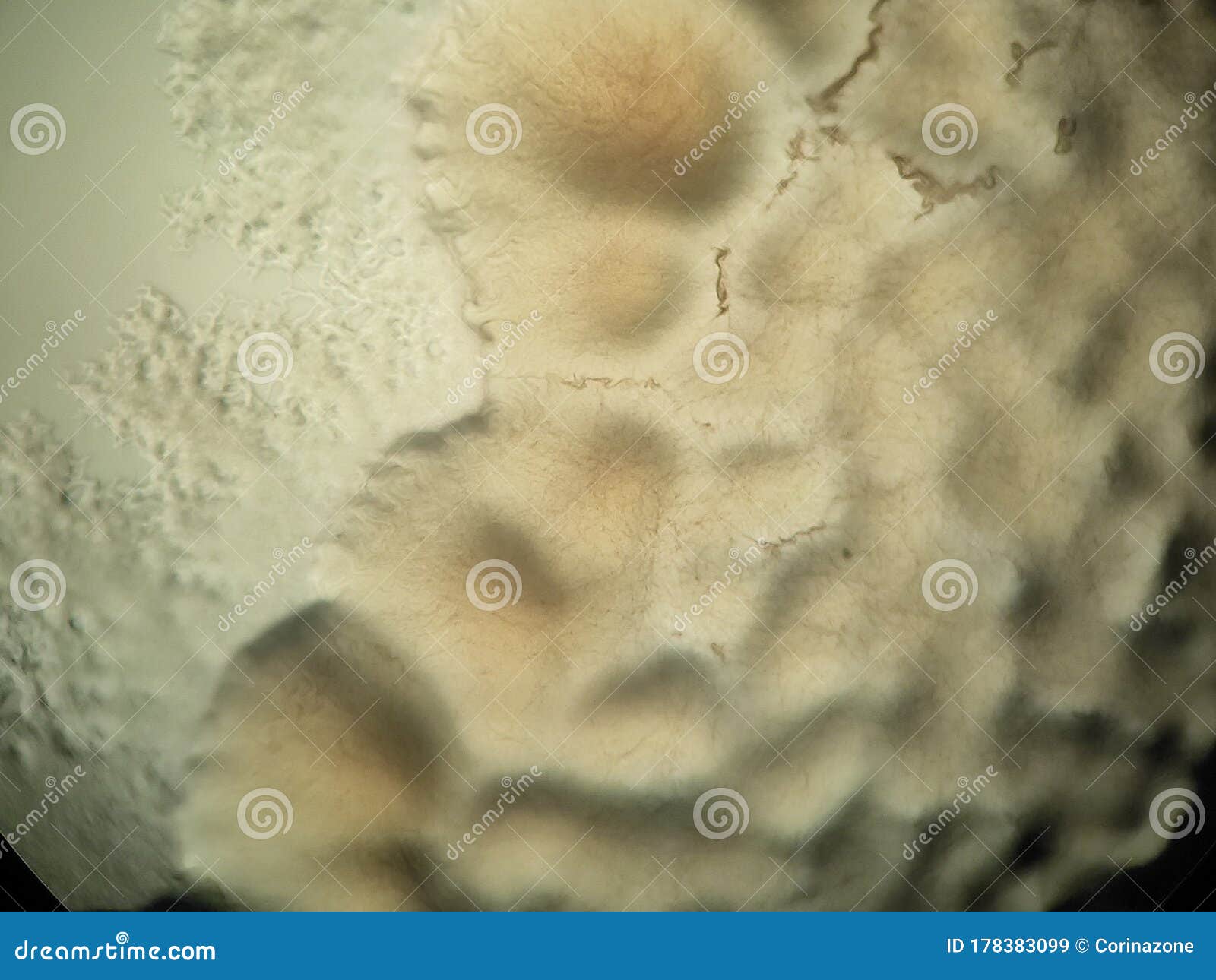Smooth Bacterial Colonies Under the Microscope Stock Image - Image of ...
