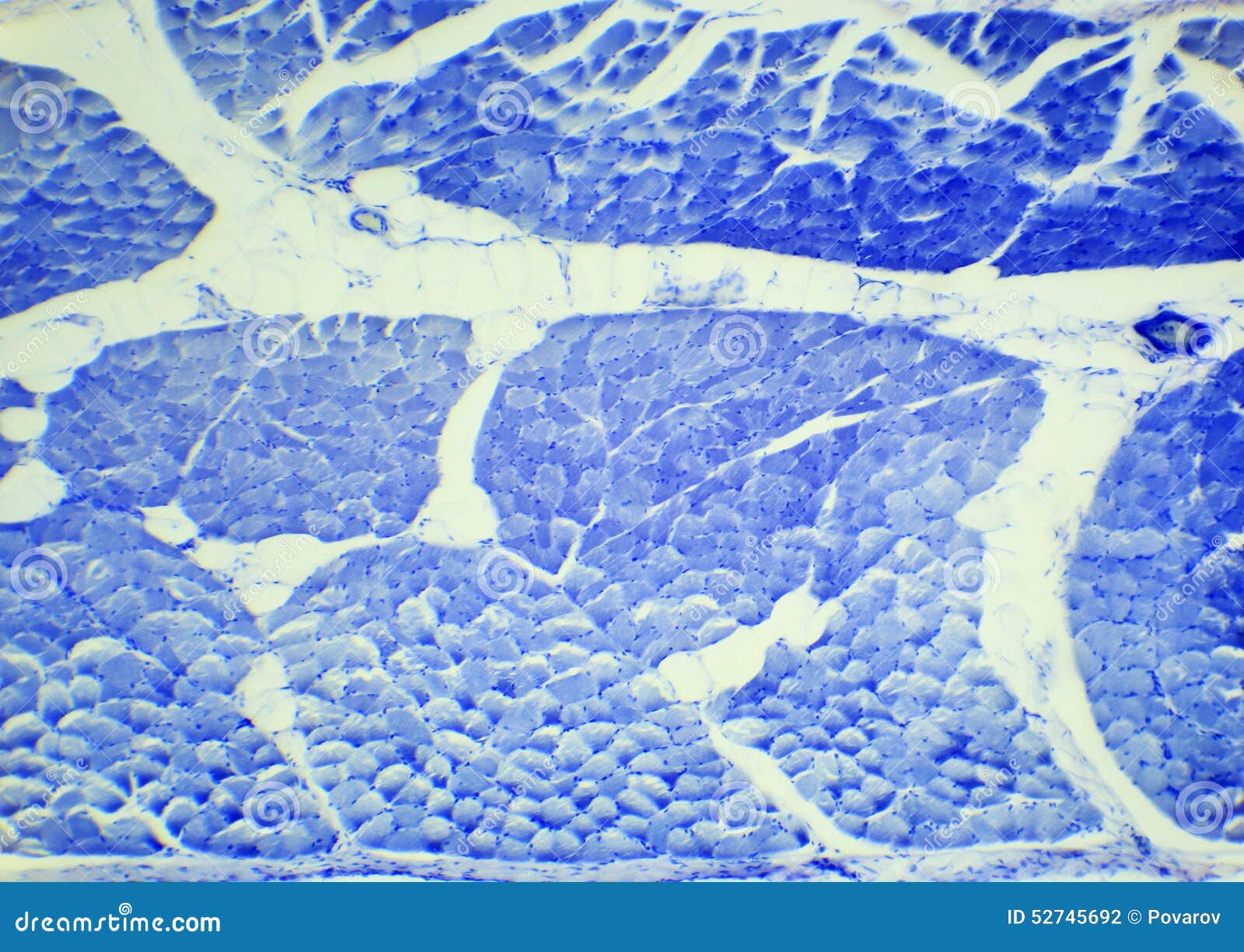 Teased Smooth Muscle Fibers Under The Microscope Royalty-Free Stock ...