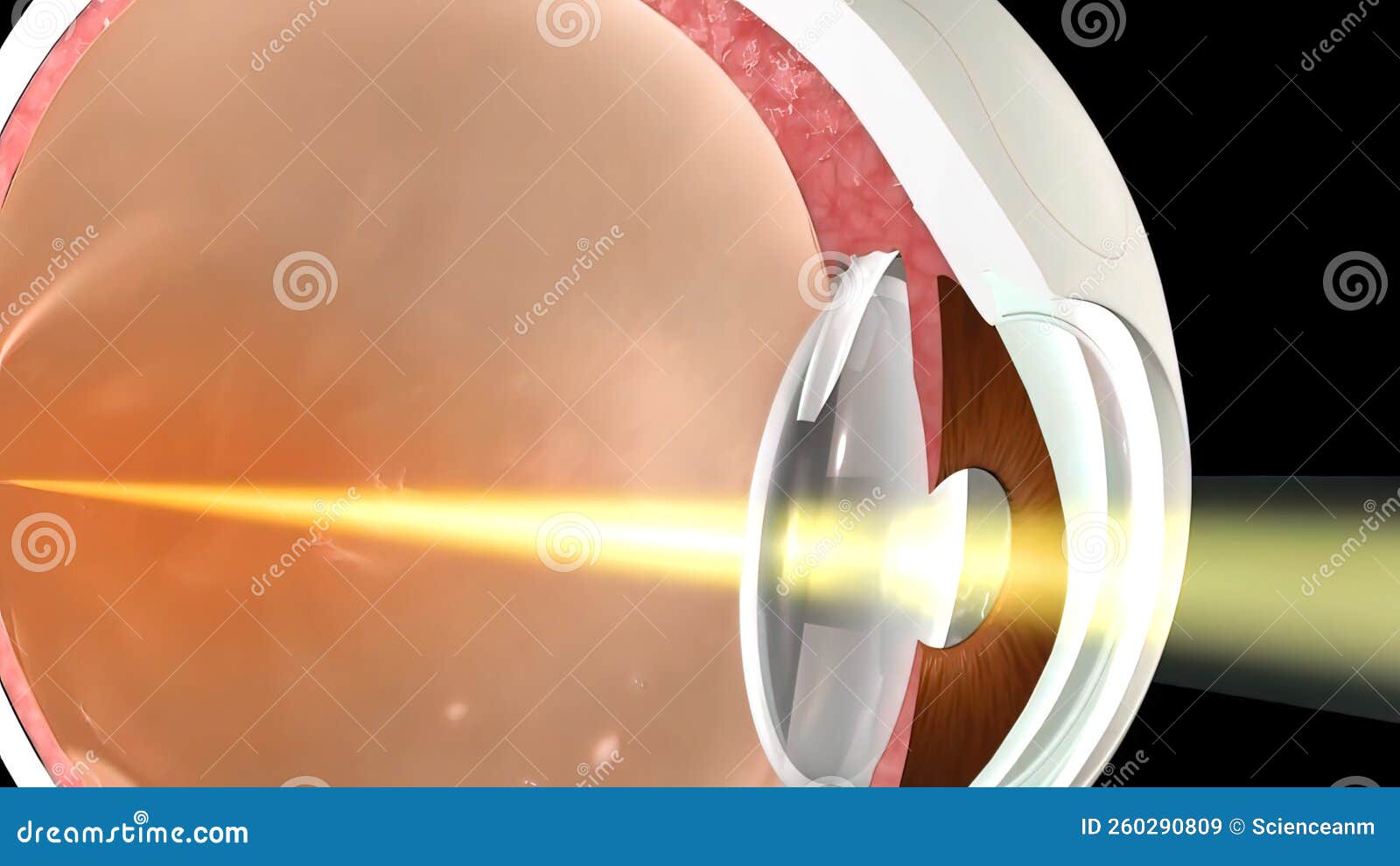 Smooth Progression of Light To the Retina Stock Illustration ...