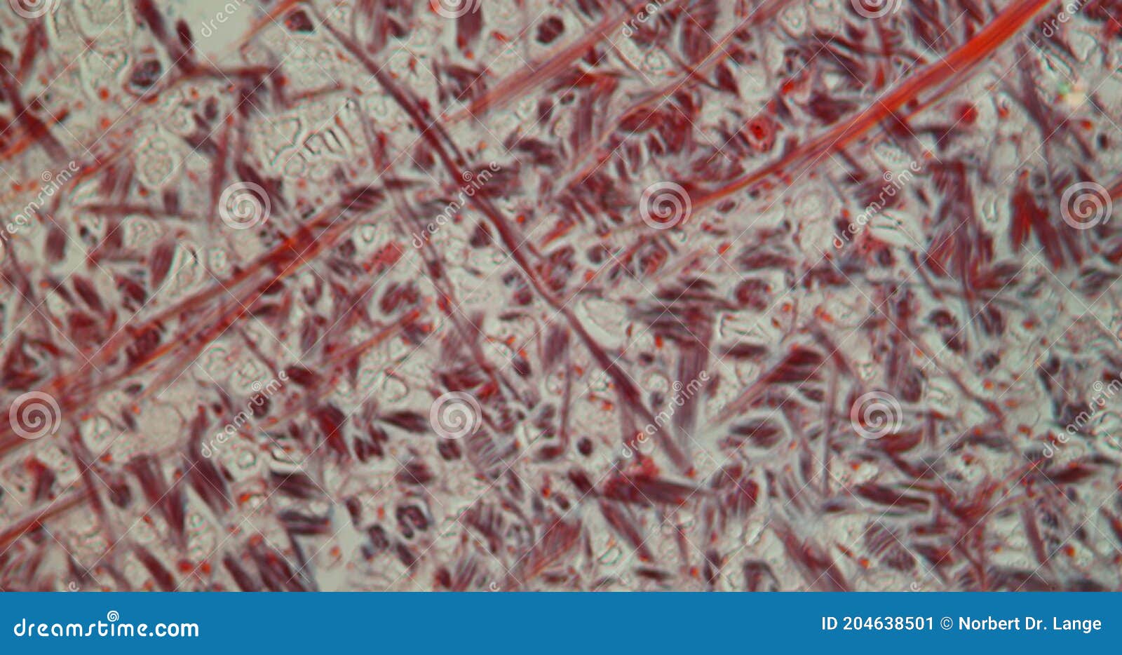 Snail foot stock video. Video of macro, secretion, foot - 204638501