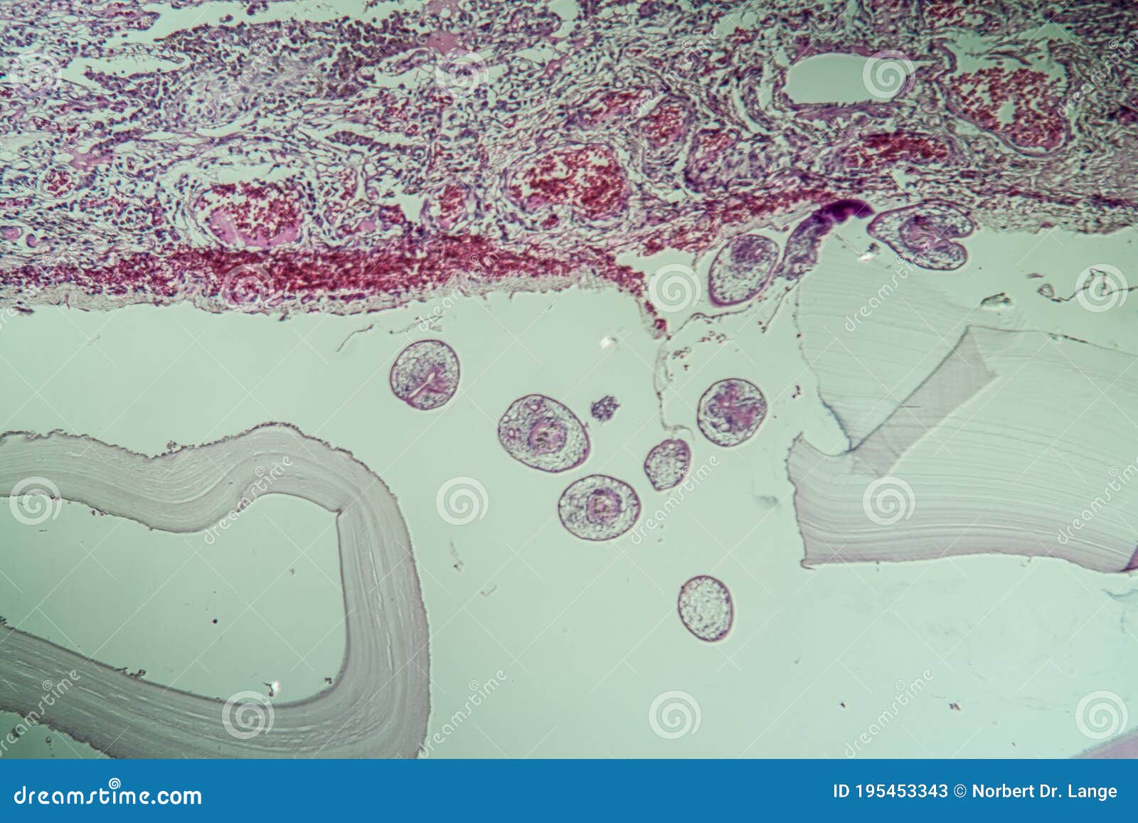 Snail Tissue with Worm Parasites Stock Image - Image of growth ...