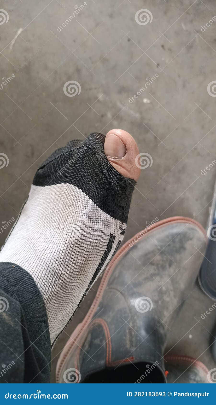 Socks that Have Holes and are Not Suitable for Use Stock Image - Image ...