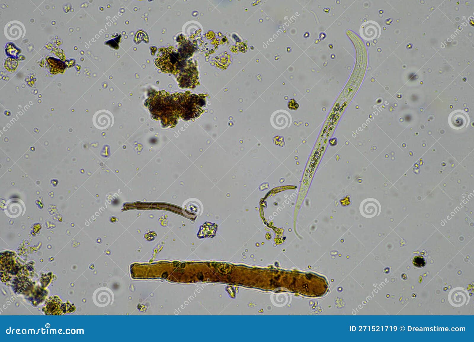 Soil Fungi, Microorganisms And Nematodes In A Soil And Compost Sample ...
