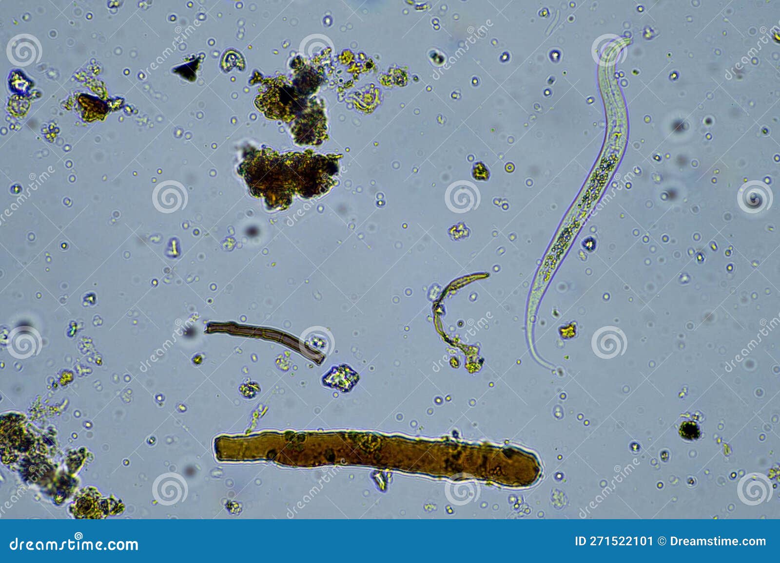 Soil Fungi, Microorganisms and Nematodes in a Soil and Compost Sample ...