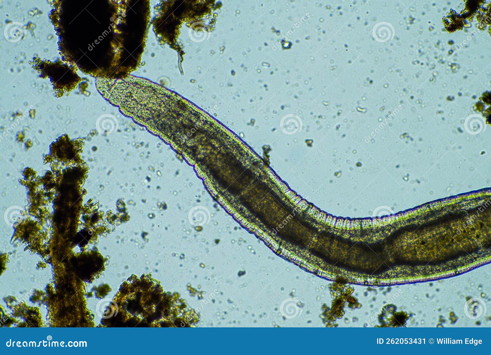 Soil Microbes Organisms In A Soil And Compost Sample, Fungus And Fungi ...