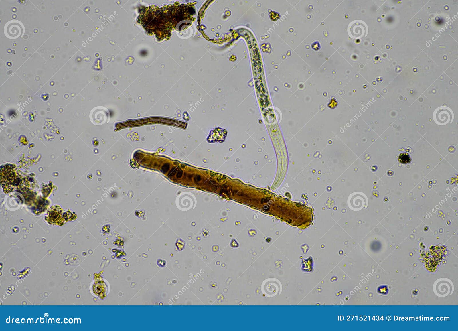 Soil Microbes and Nematodes in a Compost on a Farm in India Stock Photo ...
