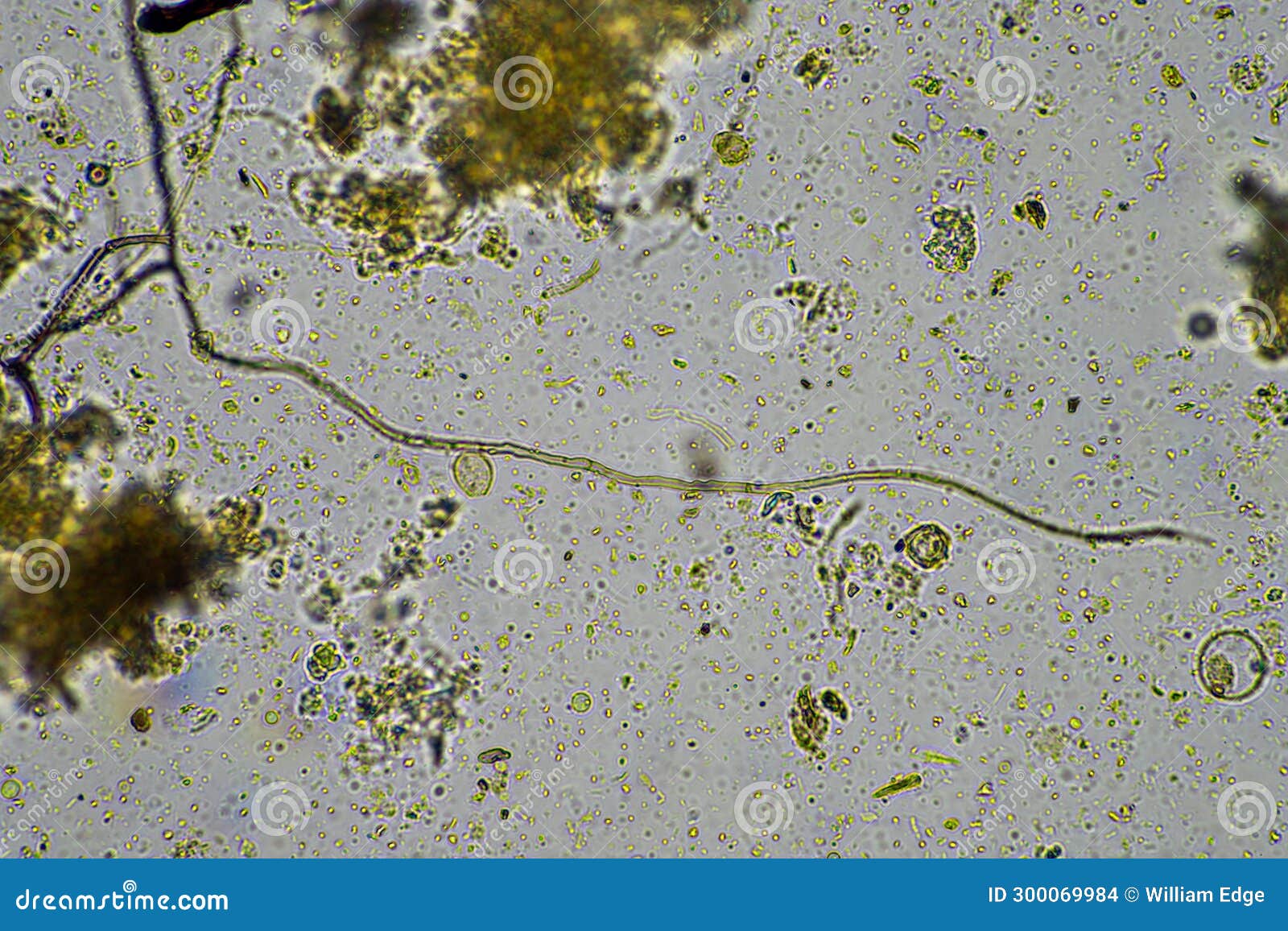 Soil Microbes Organisms In A Soil And Compost Sample, Fungus And Fungi ...