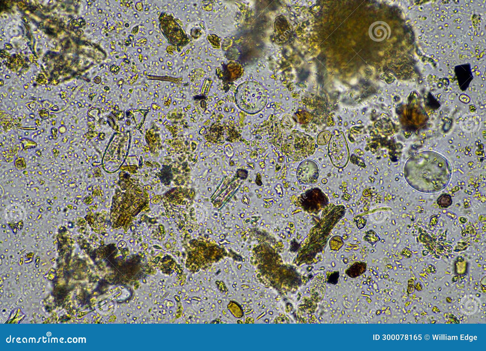 Soil Microbes Organisms In A Soil And Compost Sample, Fungus And Fungi ...