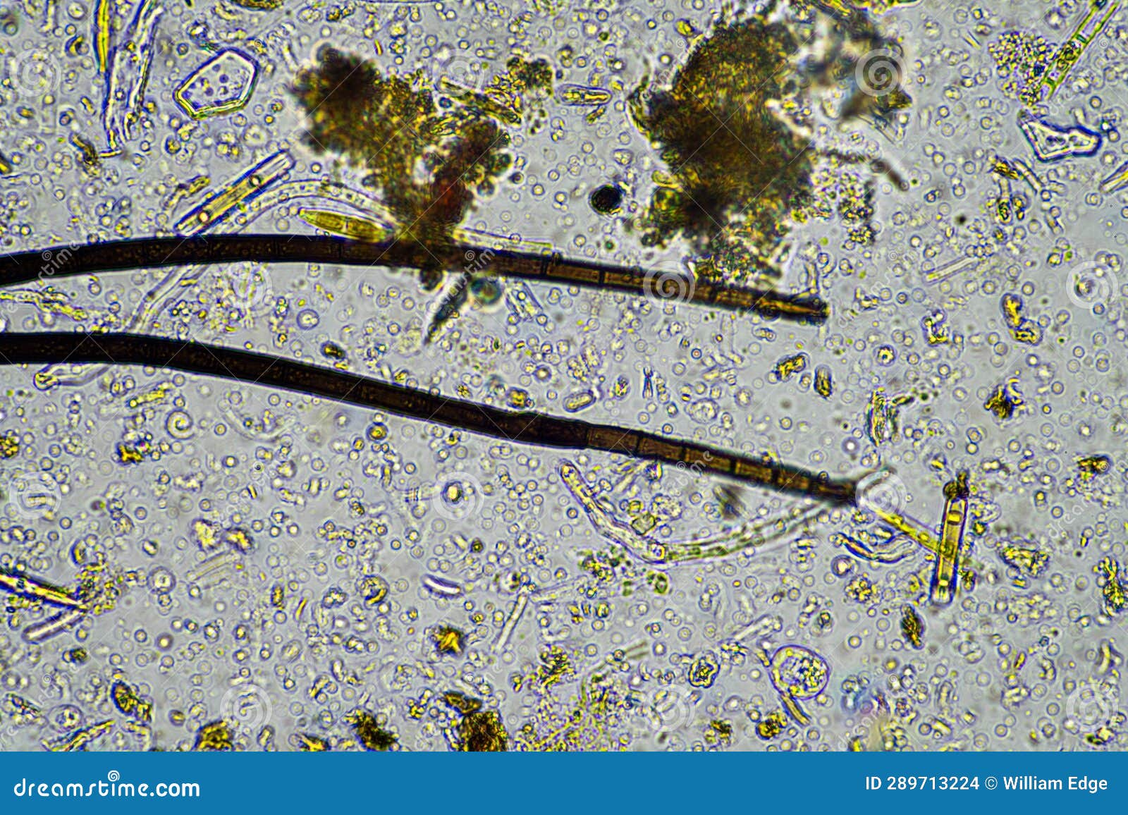 Soil Microorganisms Close Up Under the Microscope. in a Soil Samlple ...