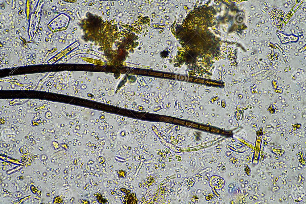 Soil Microorganisms Close Up Under the Microscope. in a Soil Samlple ...