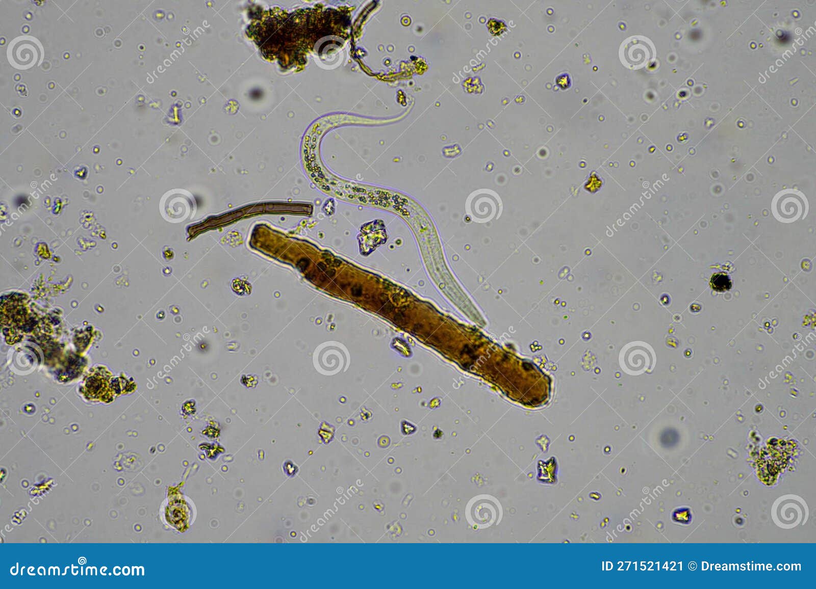 Soil Microorganisms In A Soil Sample, Soil Fungus And Bacteria On A ...