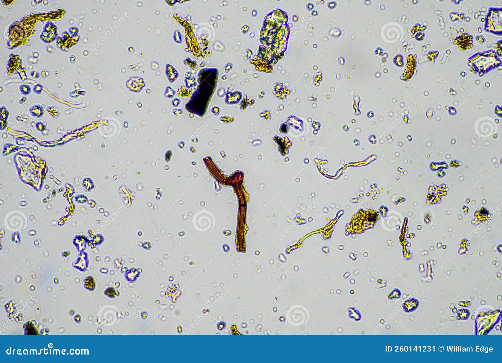 Soil Sample Under the Microscope. Soil Fungi and Microorganisms Cycling ...