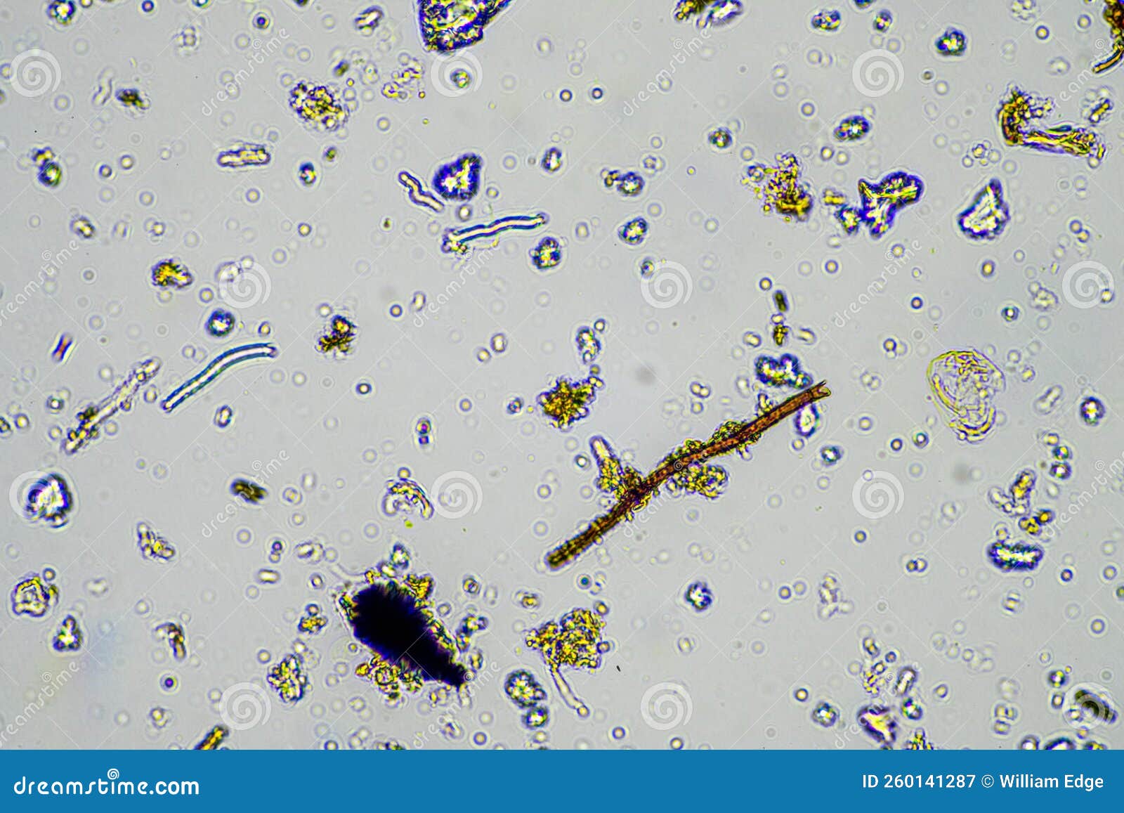 Soil Fungi, Microorganisms And Nematodes In A Soil And Compost Sample ... Soil Fungi, Microorganisms And Nematodes In A Soil And Compost Sample ...