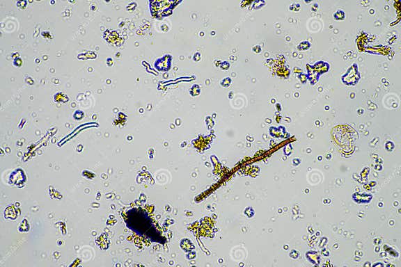 Soil Sample Under the Microscope. Soil Fungi and Microorganisms Cycling ...