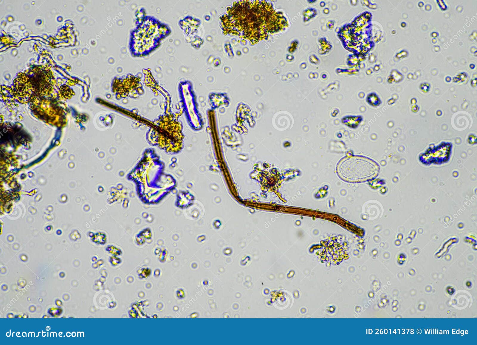 Soil Sample Under the Microscope. Soil Fungi and Microorganisms Cycling ...