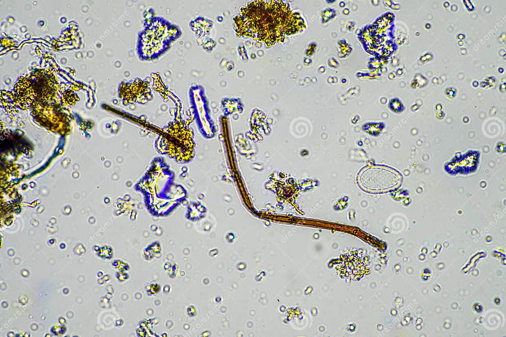 Soil Sample Under the Microscope. Soil Fungi and Microorganisms Cycling ...
