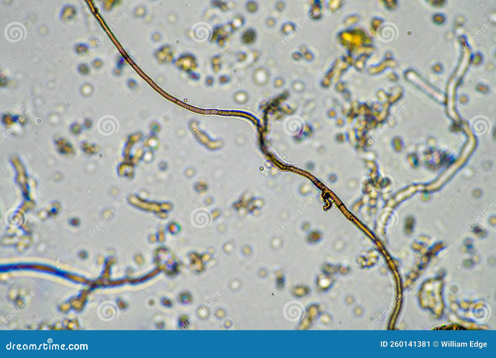 Soil Sample Under the Microscope. Soil Fungi and Microorganisms Cycling ...