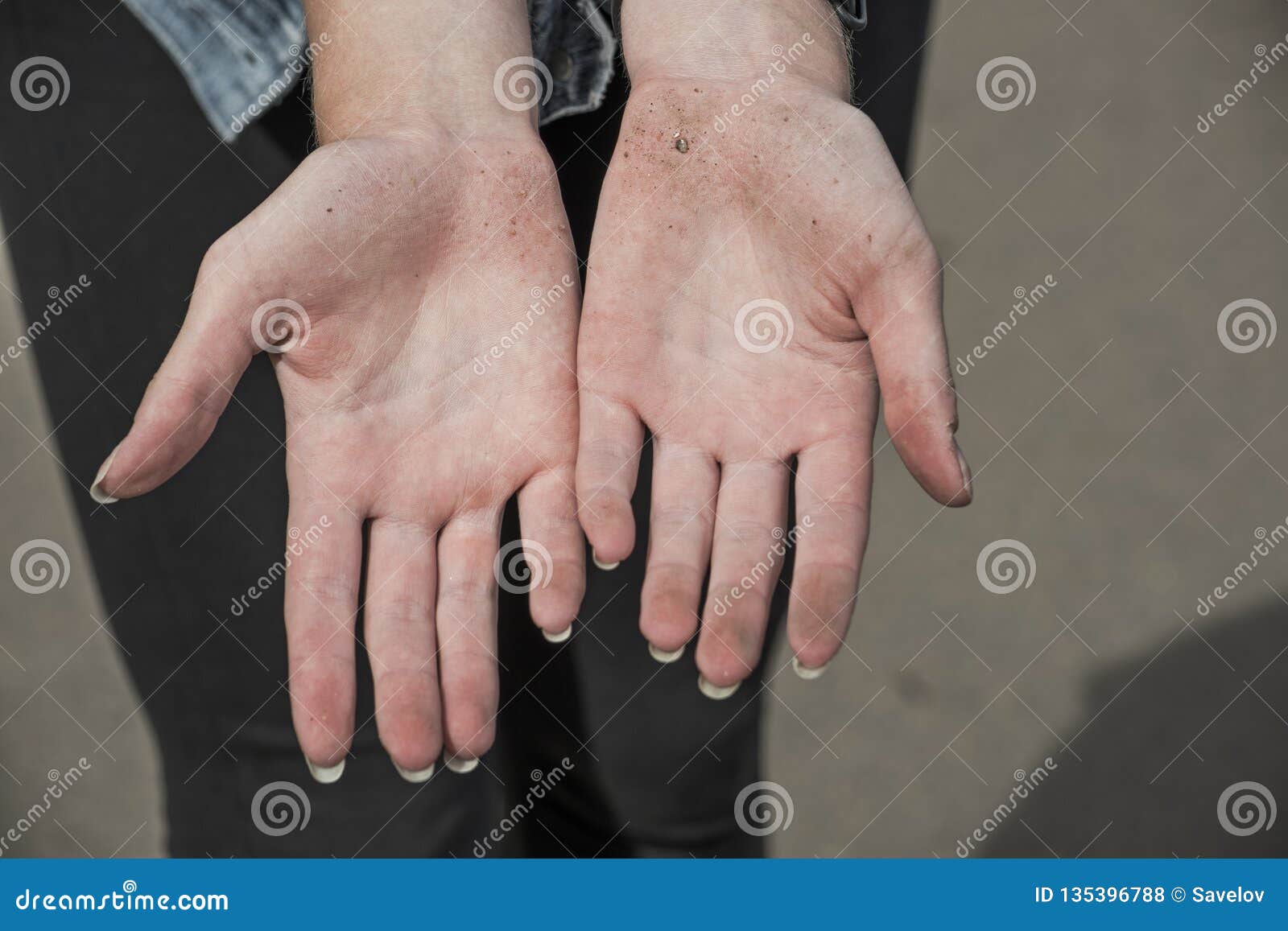 Soiled Female Hands after the Fall Stock Photo - Image of help, injury ...