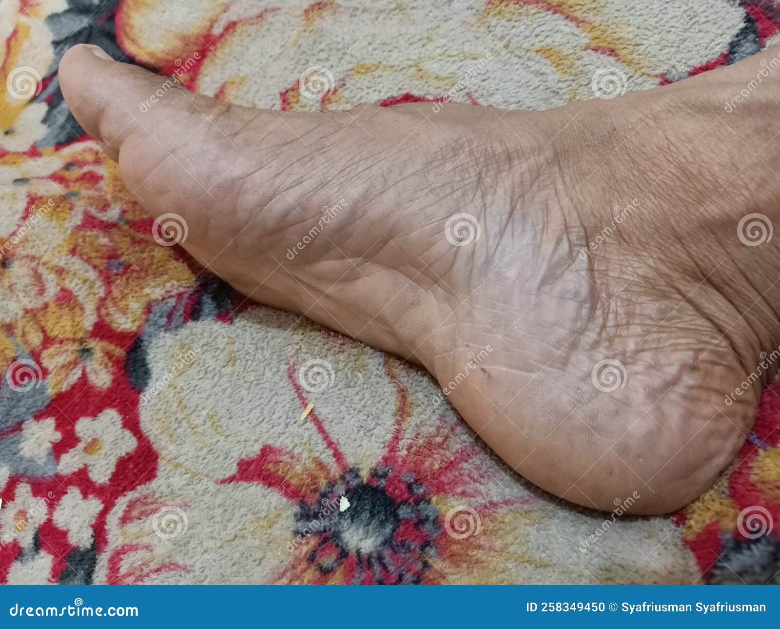 The Sole of the Right Foot is Wrinkled on the Red Carpet Stock Photo ...