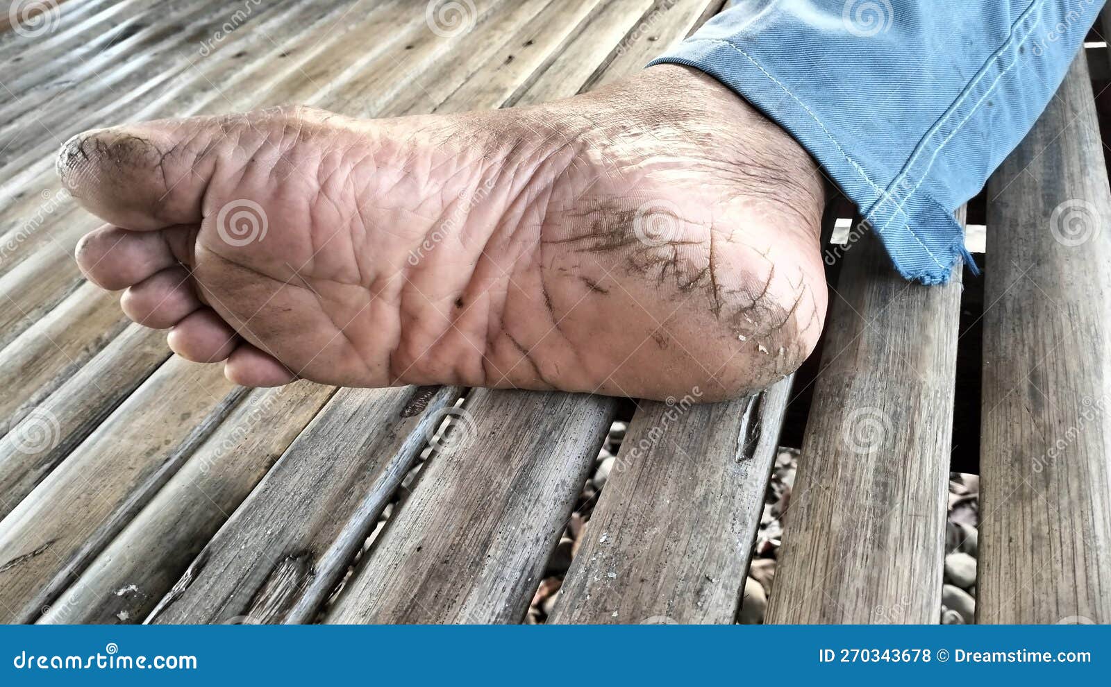The Soles of the Feet of Hardworking Men during the Day Stock Photo ...